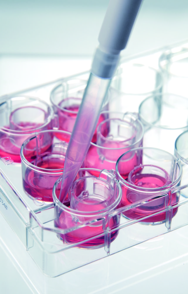 Cell culture inserts for 6-well plates PET membrane, 8.0 µm, 6x4 pcs ...